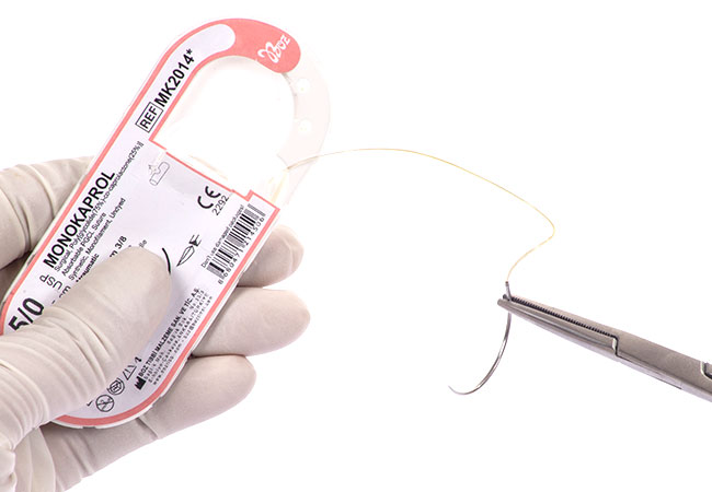 Polyglycolide-co-caprolactone PGCL Dental Suture - Monokaprol