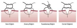 Suture Techniques Used in Veterinary Surgery - Boz Medical