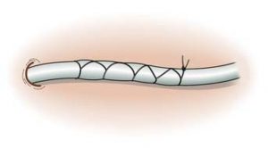Suture Techniques Used in Veterinary Surgery - Boz Medical