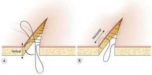Suture Techniques Used in Veterinary Surgery - Boz Medical