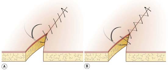 Suture Techniques Used in Veterinary Surgery - Boz Medical