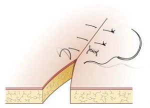 Suture Techniques Used in Veterinary Surgery - Boz Medical