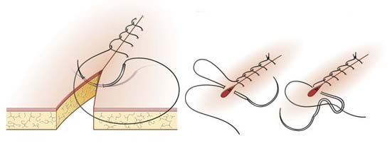 Suture Techniques Used in Veterinary Surgery - Boz Medical