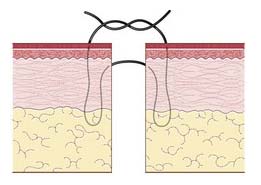 Suture Techniques Used in Veterinary Surgery - Boz Medical