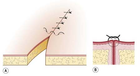 Suture Techniques Used in Veterinary Surgery - Boz Medical